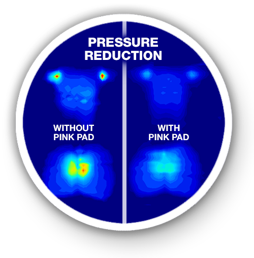 The Pink Hip Kit - Postless Hip Positioning System by Xodus Medical